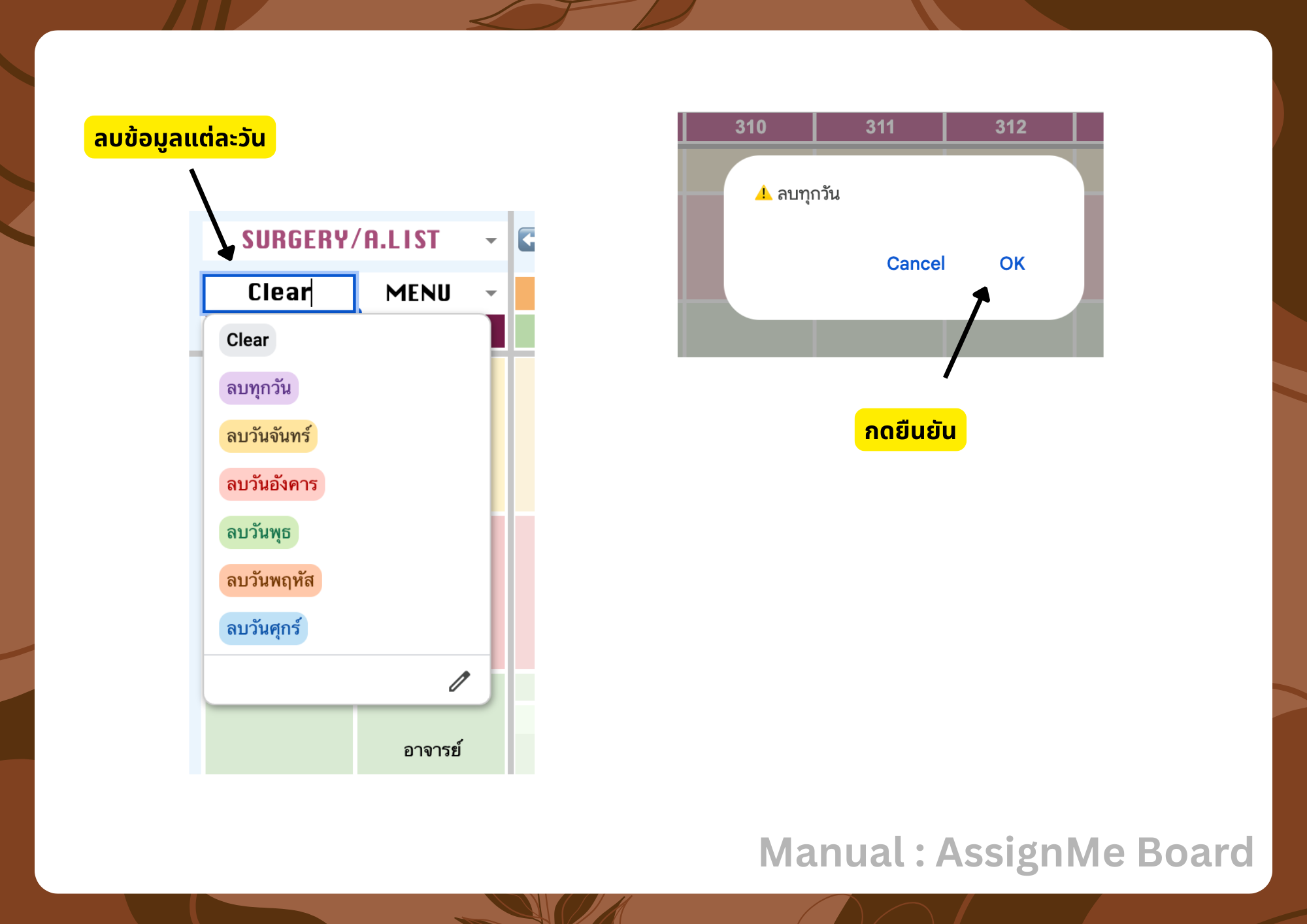 Anesthesia Assignment Board